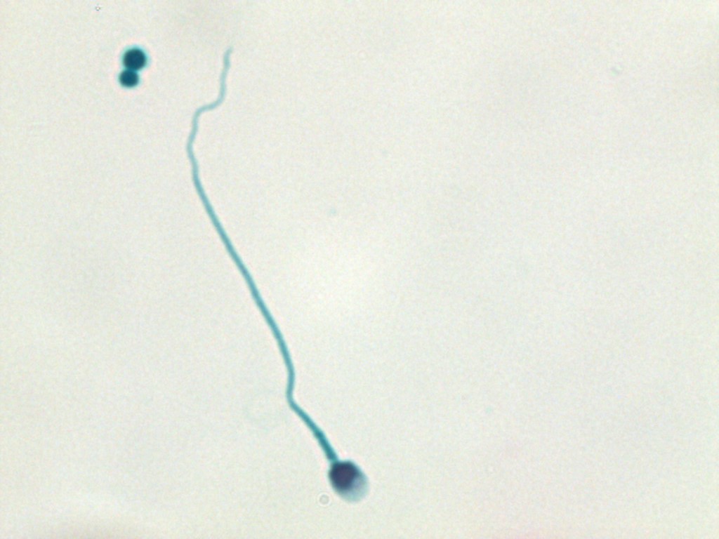 Sperm Object Detection Model by Menar