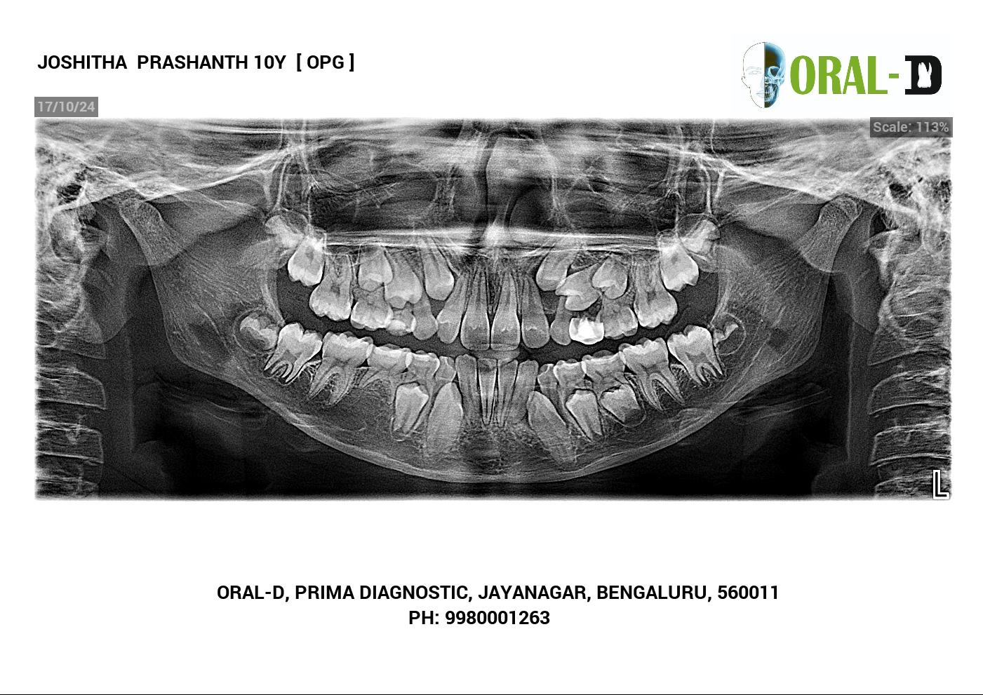 dental dataset Object Detection Dataset by dental xrays