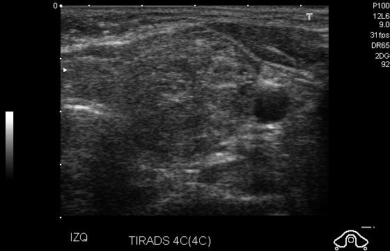 Thyroid Nodules Detection Test Object Detection Dataset And Pre Trained