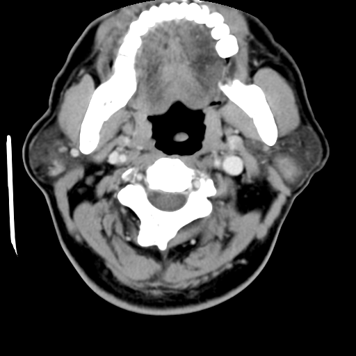 IP_FinalProject Object Detection Dataset by Machine Learning