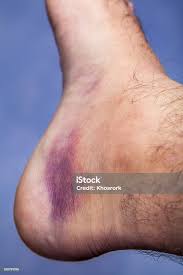 Tugas Akhir (tugas-akhir-acqpa) - Roboflow Universe