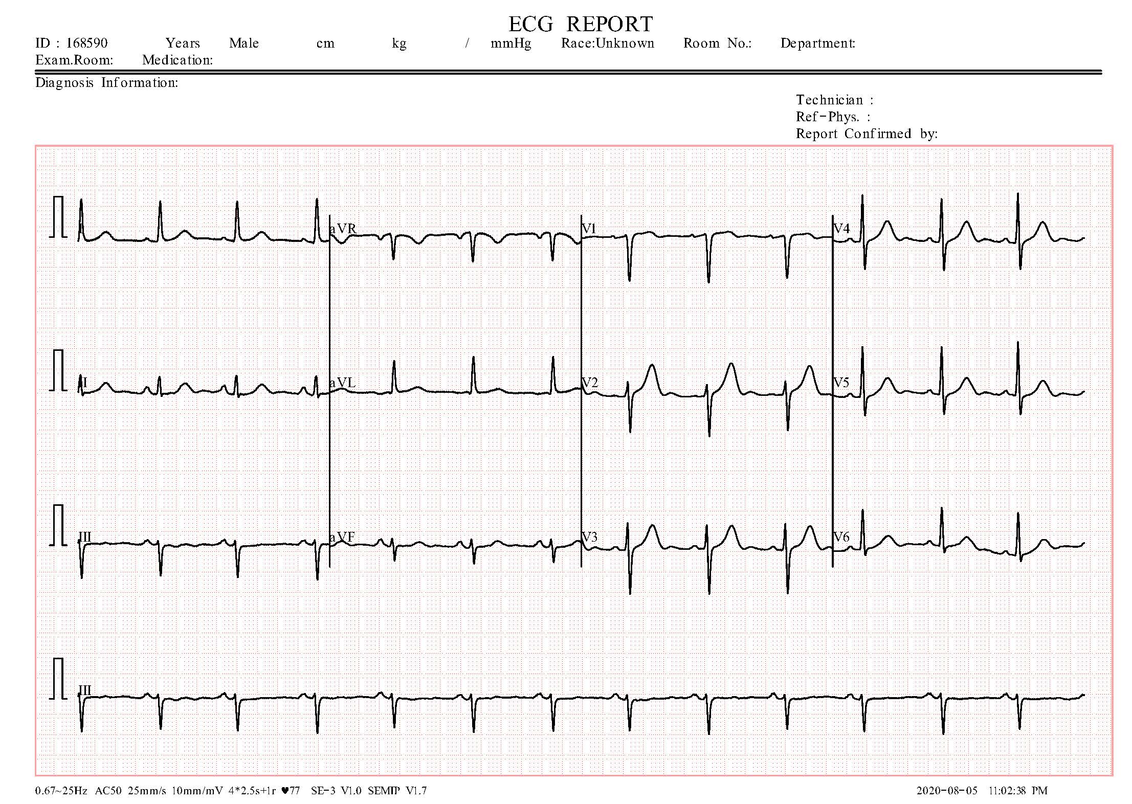 Heart Disease Classification Model by Student