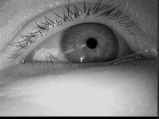 eye detection Object Detection Model by Aleksei Adamenko