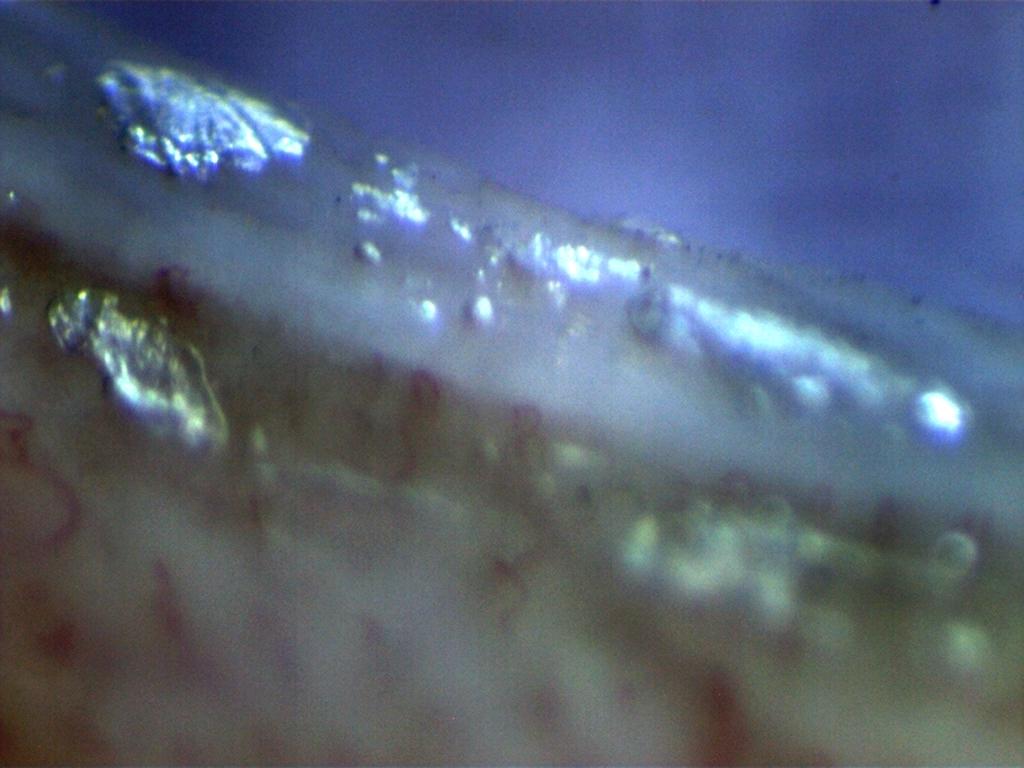 ANFC-THU Object Detection Dataset by Nailfold Capillary