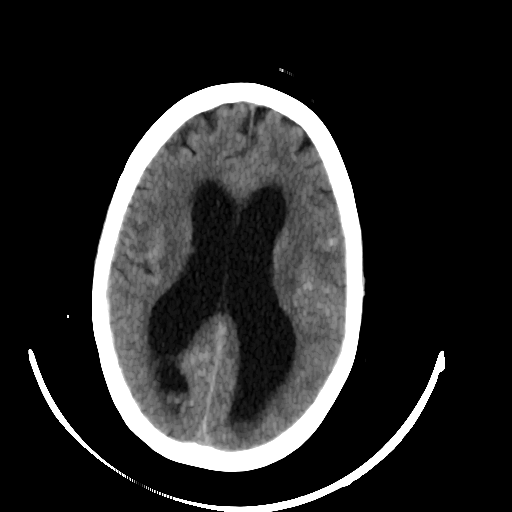 brain Object Detection Dataset by Brain Hemorrhage Detection