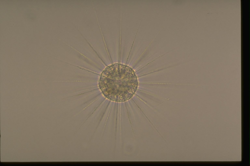 microbe classification ssd Object Detection Dataset and Pre-Trained Model by SSDCUSTOM