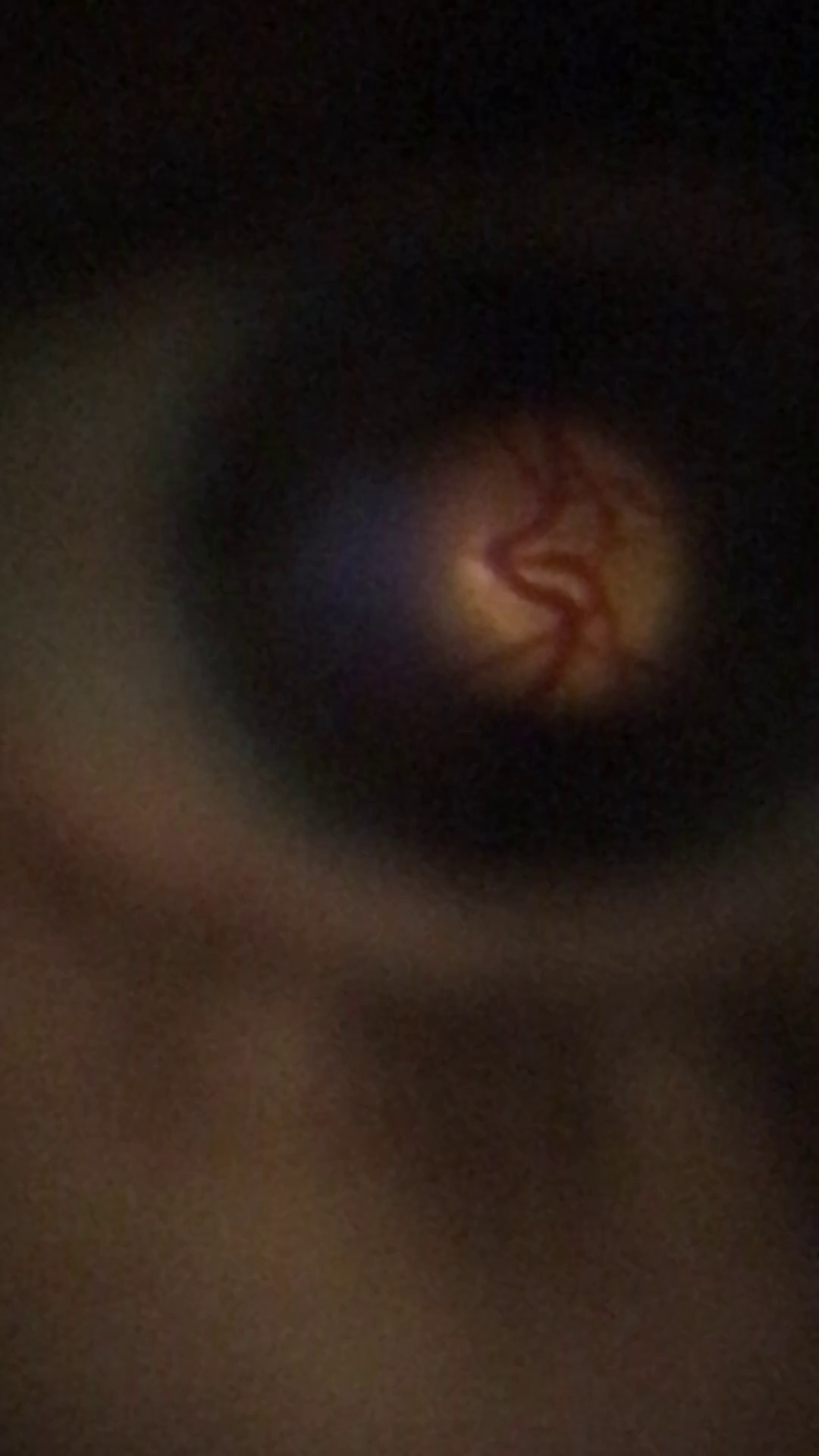 Retina Segmentation Complete Object Detection Dataset and Pre-Trained ...