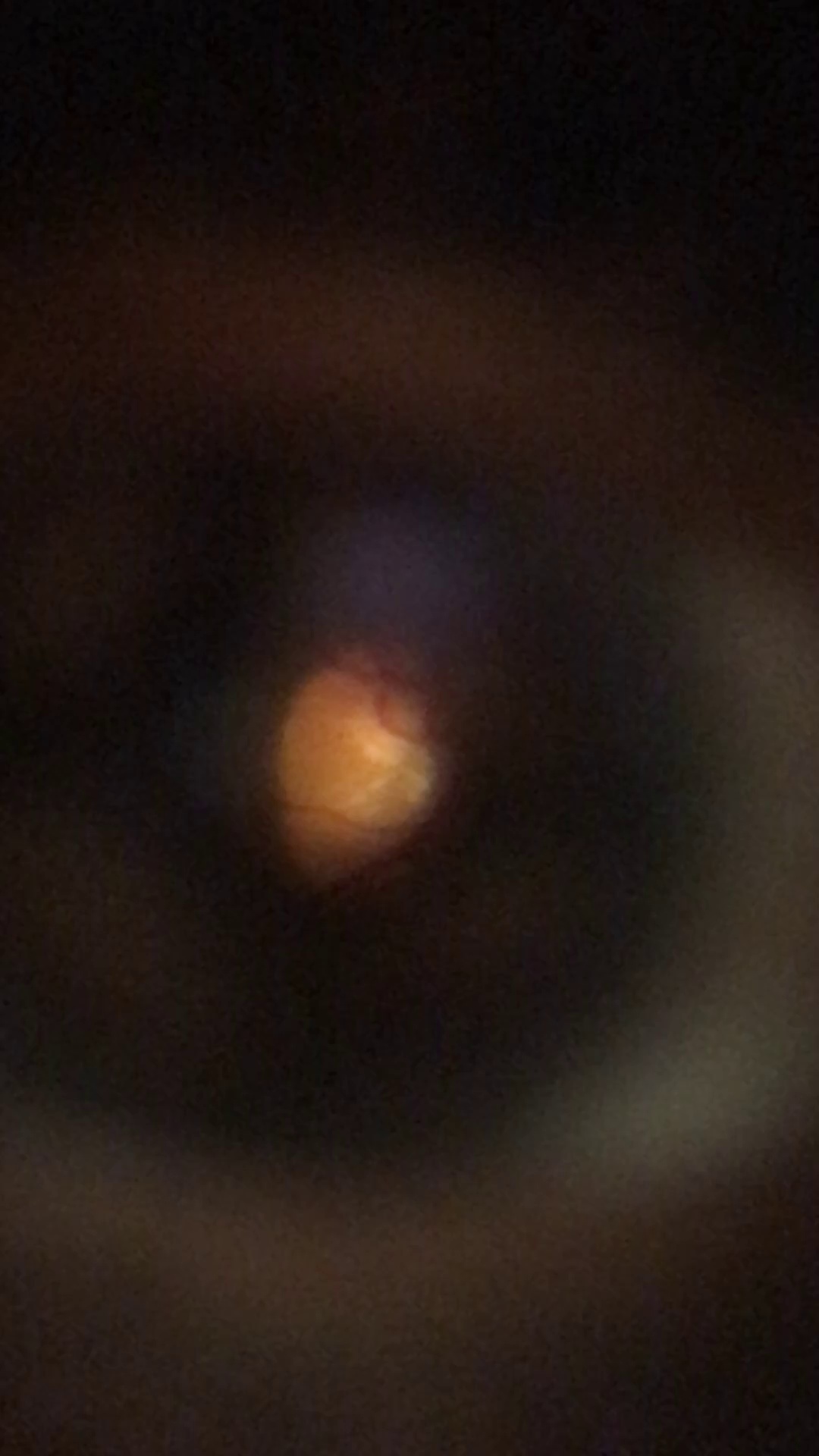 Retina Segmentation Object Detection Model by UFMA
