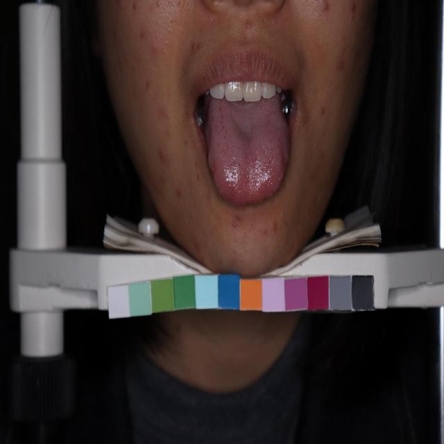 TONGUE Detection Object Detection Dataset by pengfei he