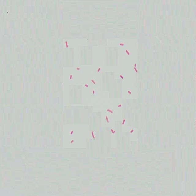 Bacteria Detection Object Detection Dataset And Pre Trained Model By