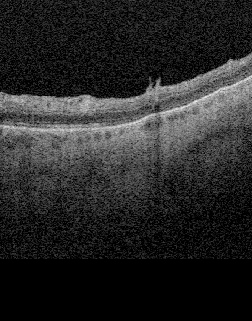 segmentation Object Detection Dataset by Moe384