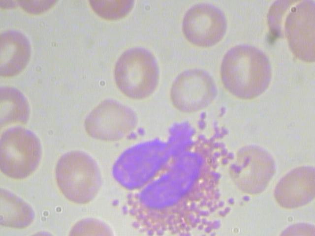 Blood Cell Cella+BCCD Object Detection Dataset and Pre-Trained Model by long
