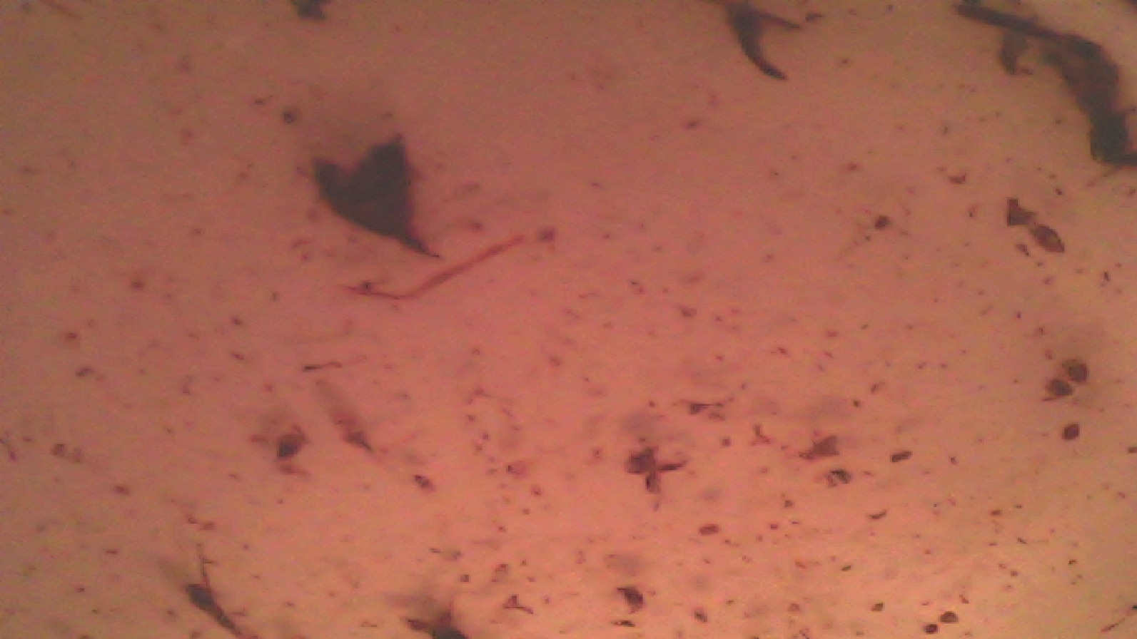 Microplastics Detection Object Detection Dataset And Pre Trained Model