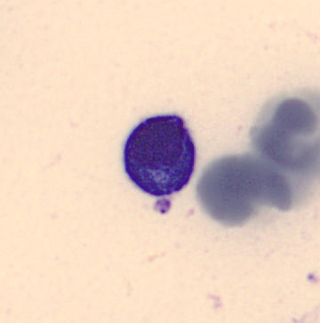 blood smear Object Detection Dataset by Hiena