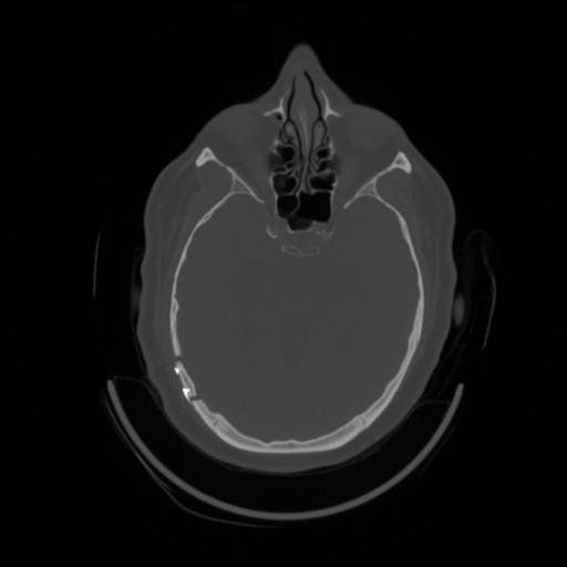 mri Instance Segmentation Model by easyradiology