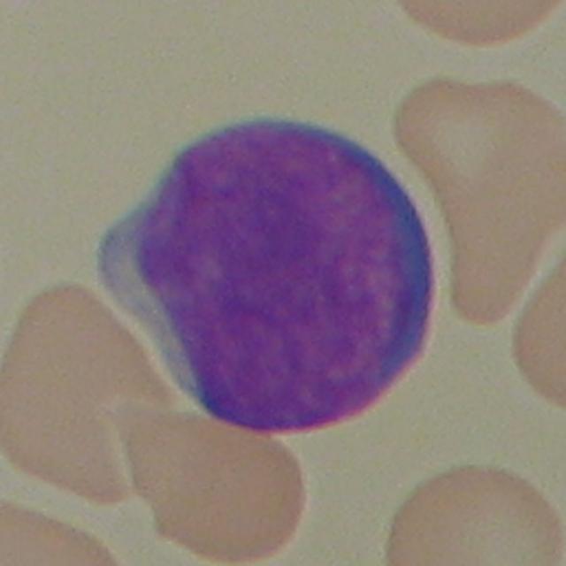 Lukemia ALLDB Object Detection Dataset by Aspiring machine learning expert