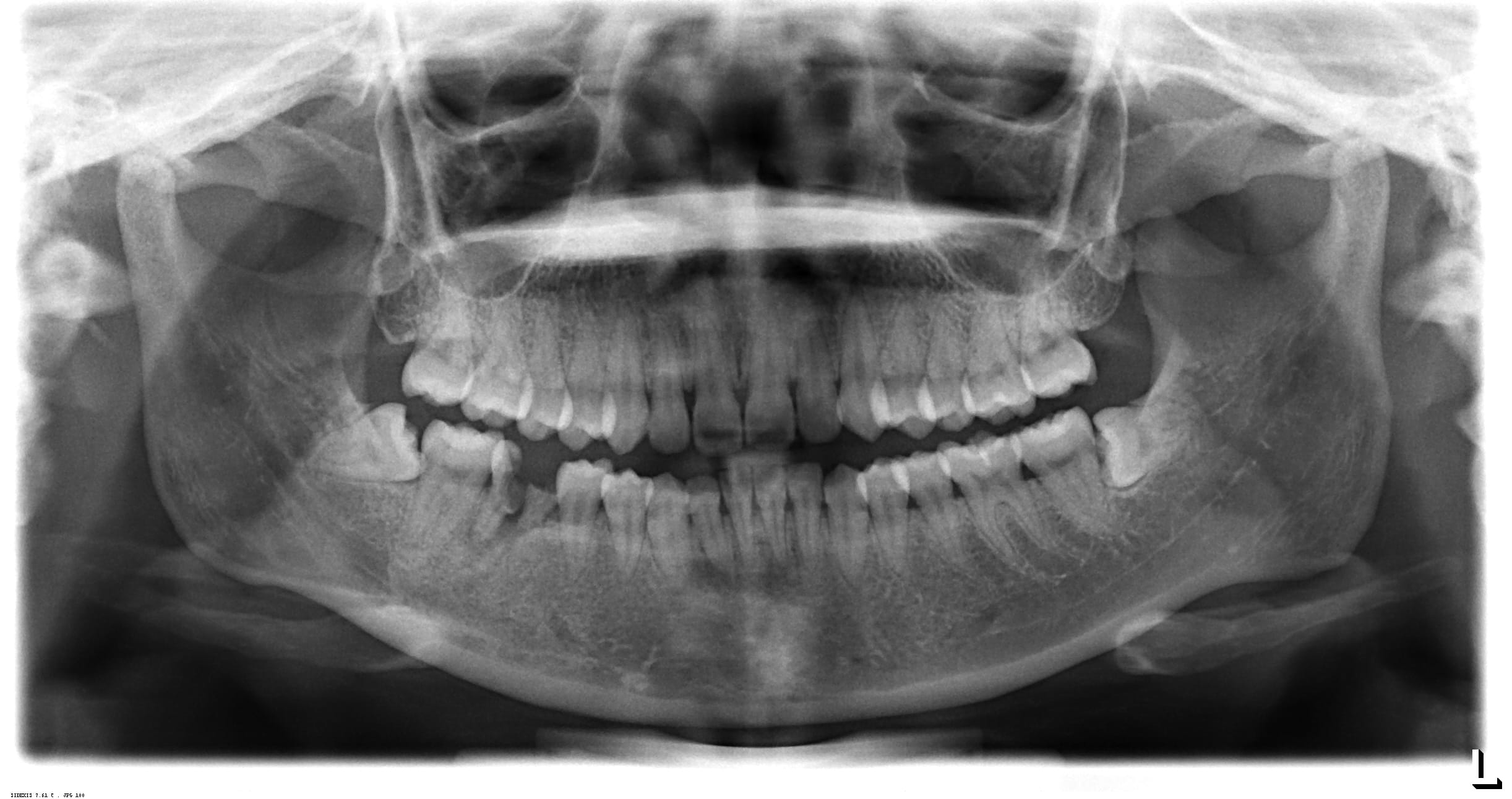 Thesis-Project Object Detection Dataset by YOLOv8