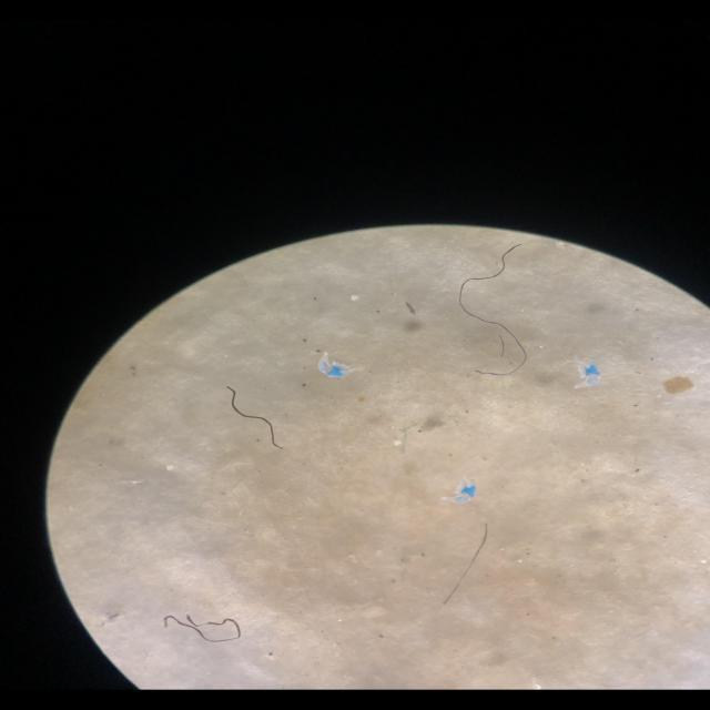 microplastic-modified Instance Segmentation Dataset by Project