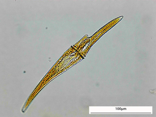 Phytoplankton Object Detection Model by PROJECT 1