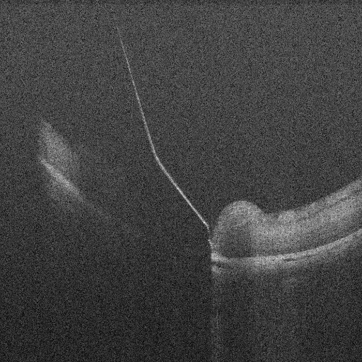 puncture_detection Object Detection Dataset by puncturedetection