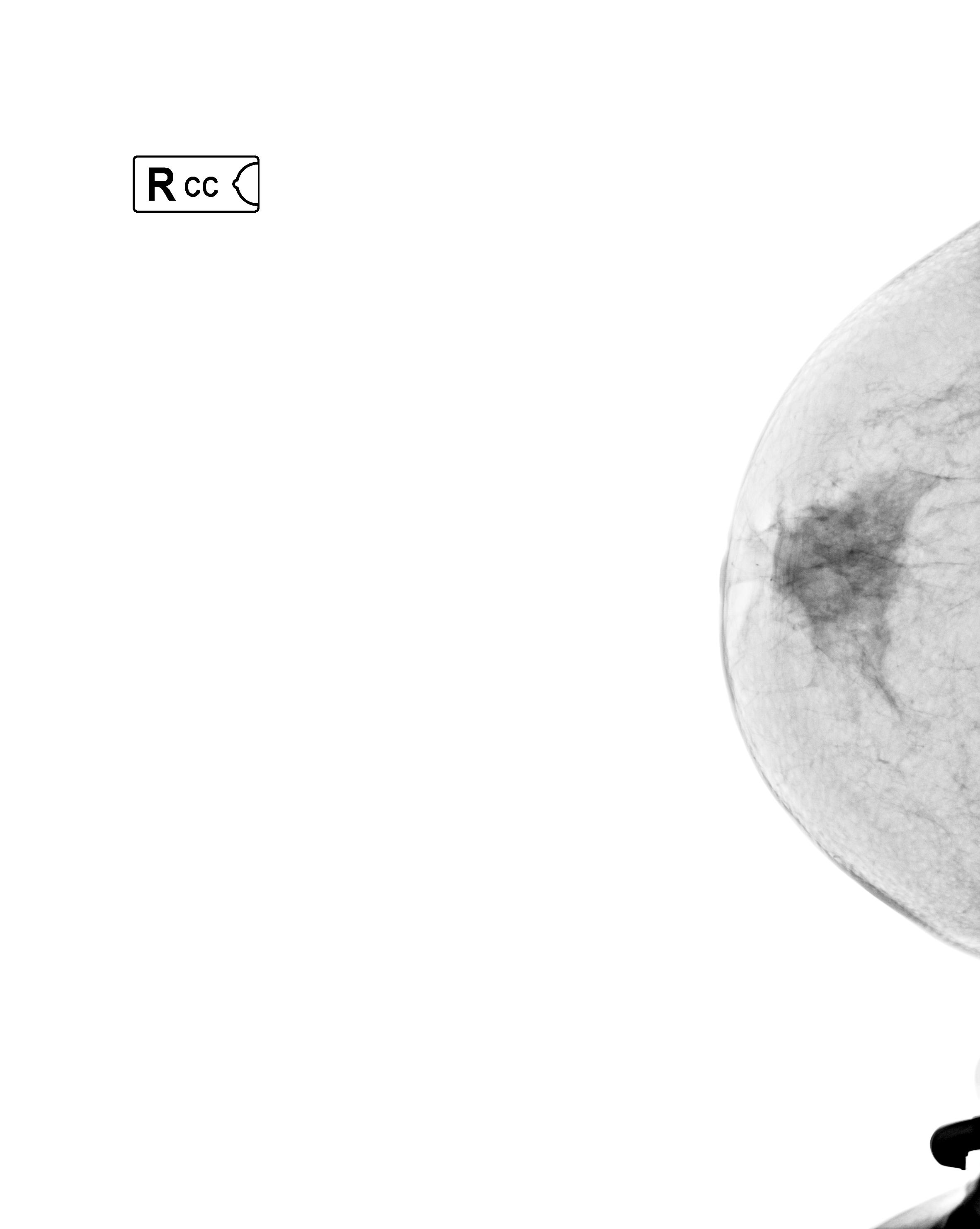 Syz Dataset Object Detection Dataset By Baloon Detection
