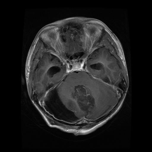 MRI Classification Model by NISER