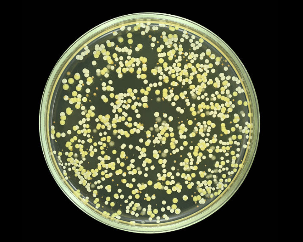 colony-counter Object Detection Model by thisIsMySWAMP