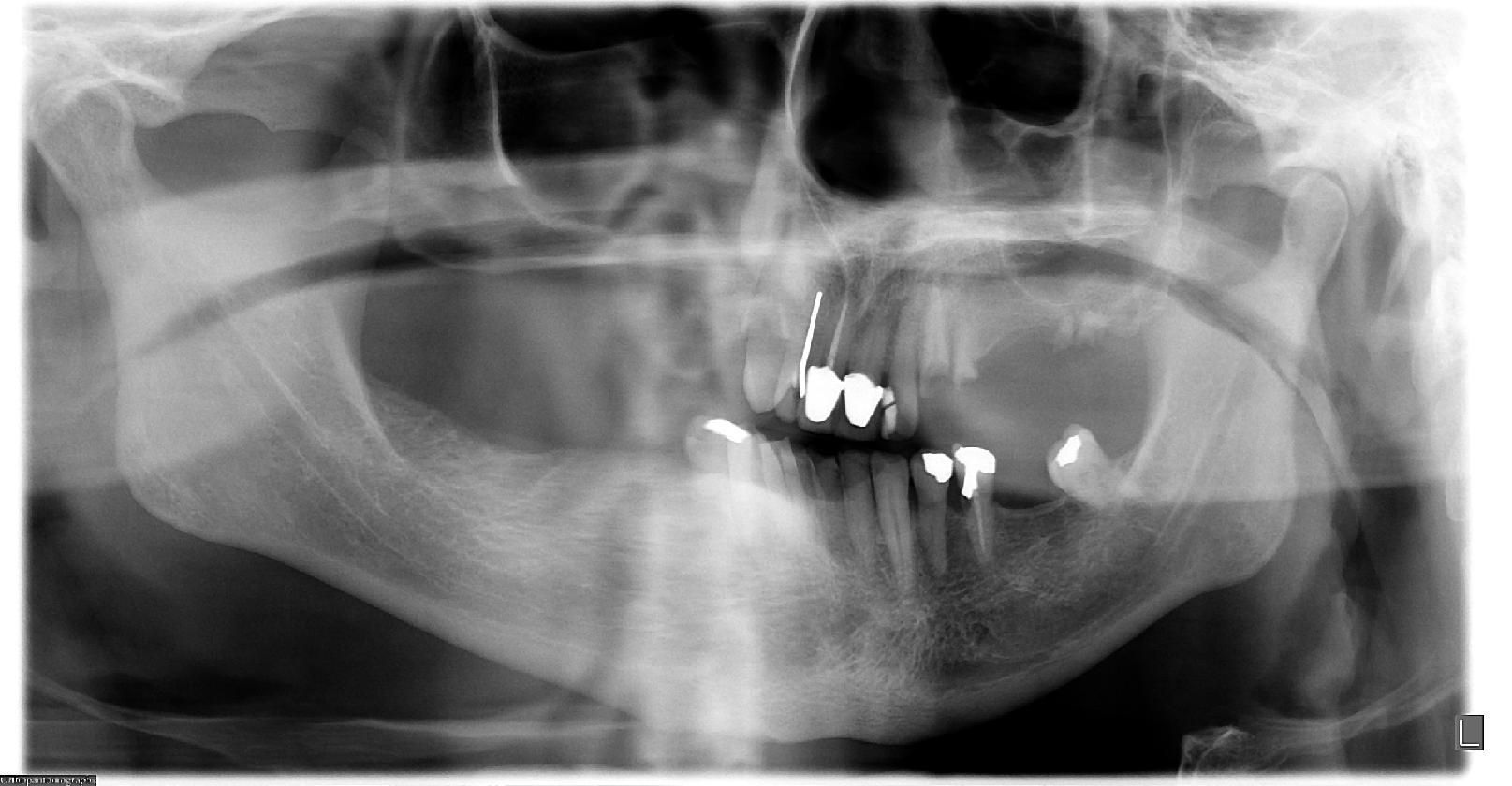 new_opg_anlyzer Instance Segmentation Dataset by ProjectOPG
