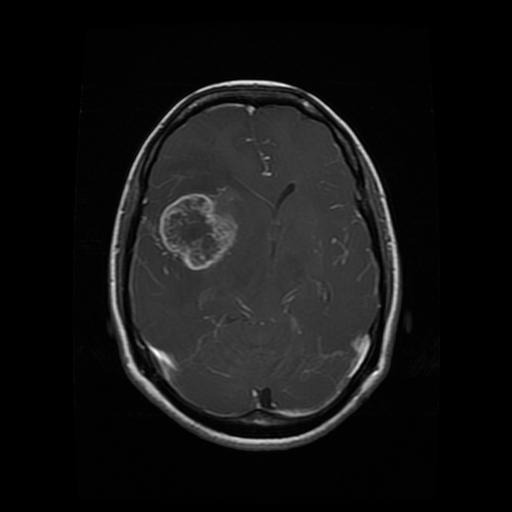 Brain Object Detection Dataset and Pre-Trained Model by Project