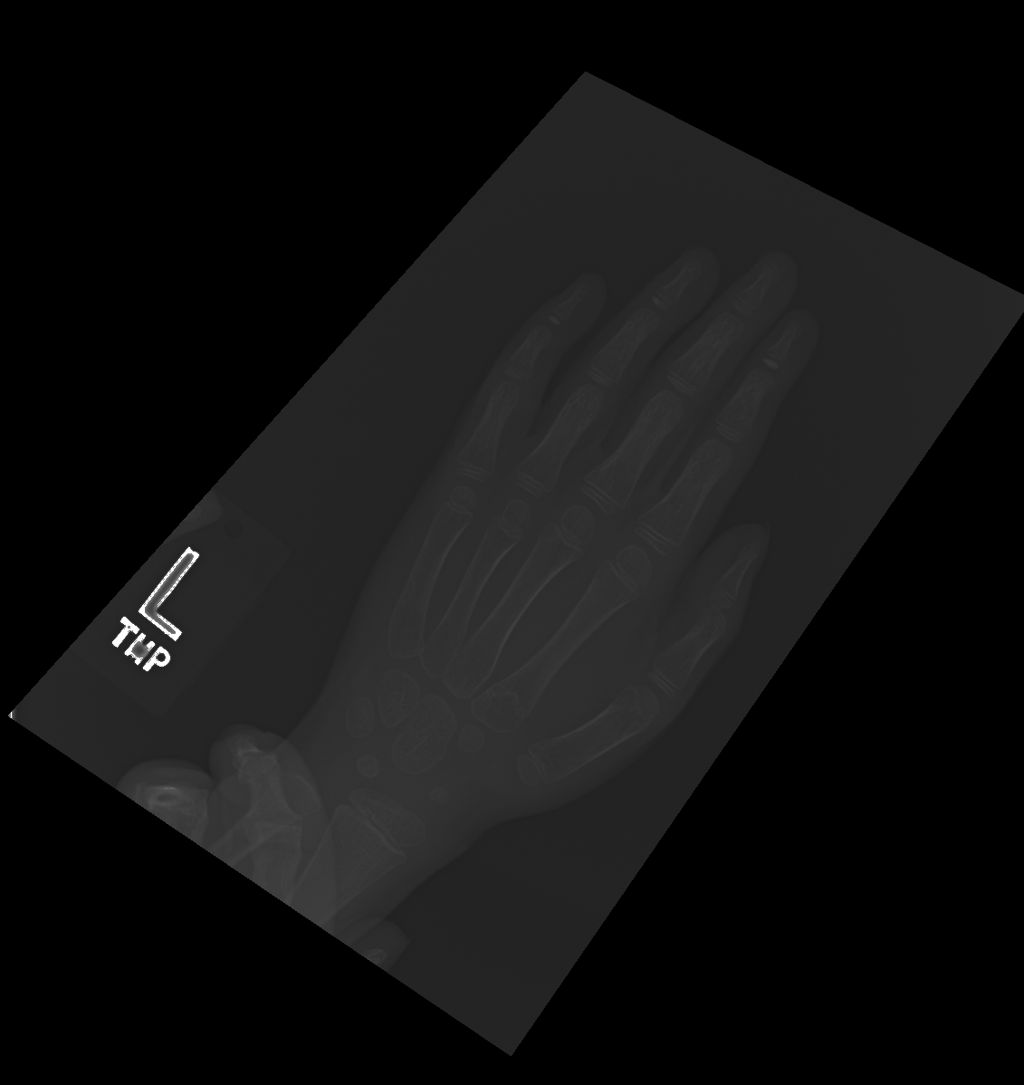 RA hands Object Detection Model by First