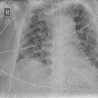 Nvid - Roboflow Universe