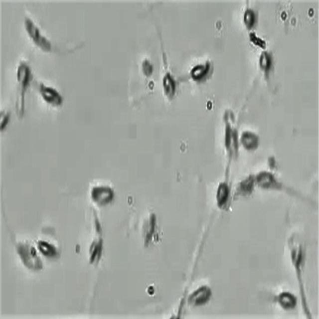 sperm detect Object Detection Dataset by light