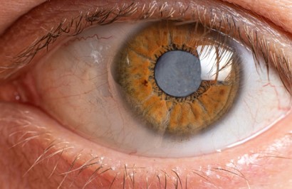 Eye Deficiency Detection2 Classification Model by Eyemodel