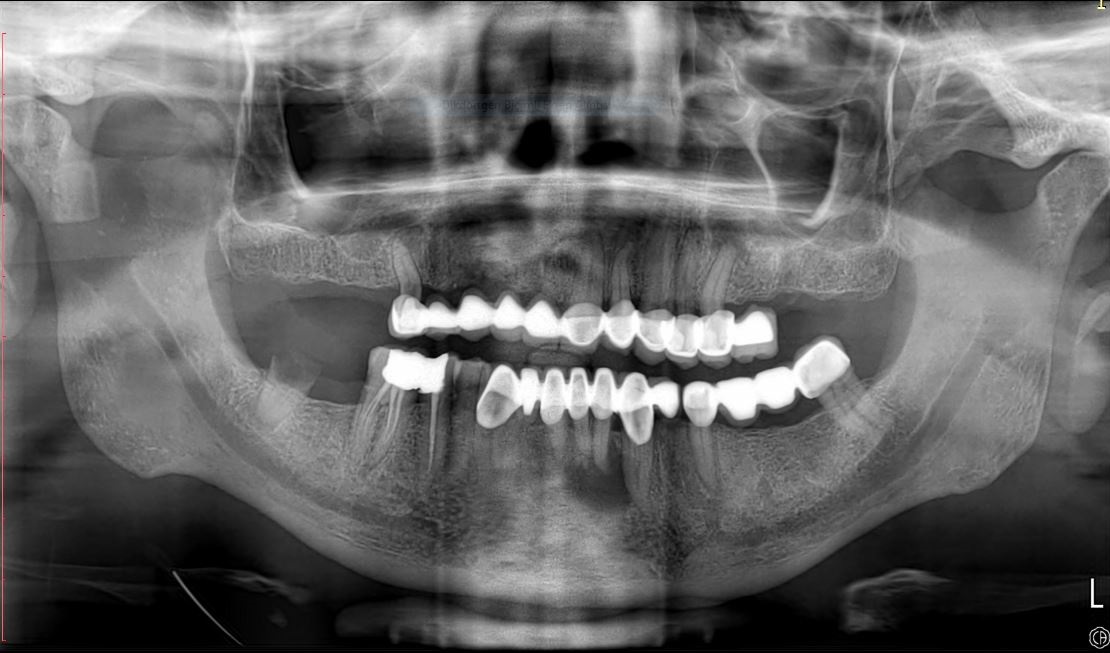 dental Object Detection Model by dnt