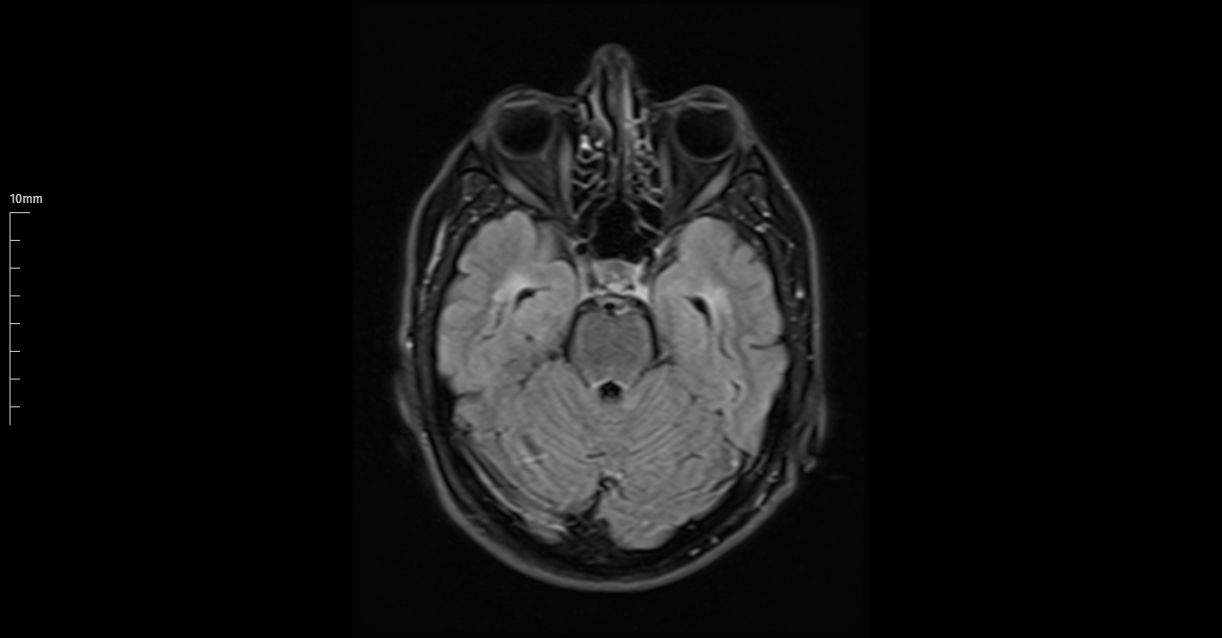 ms-data-set-seg Instance Segmentation Dataset by Vincius Souza