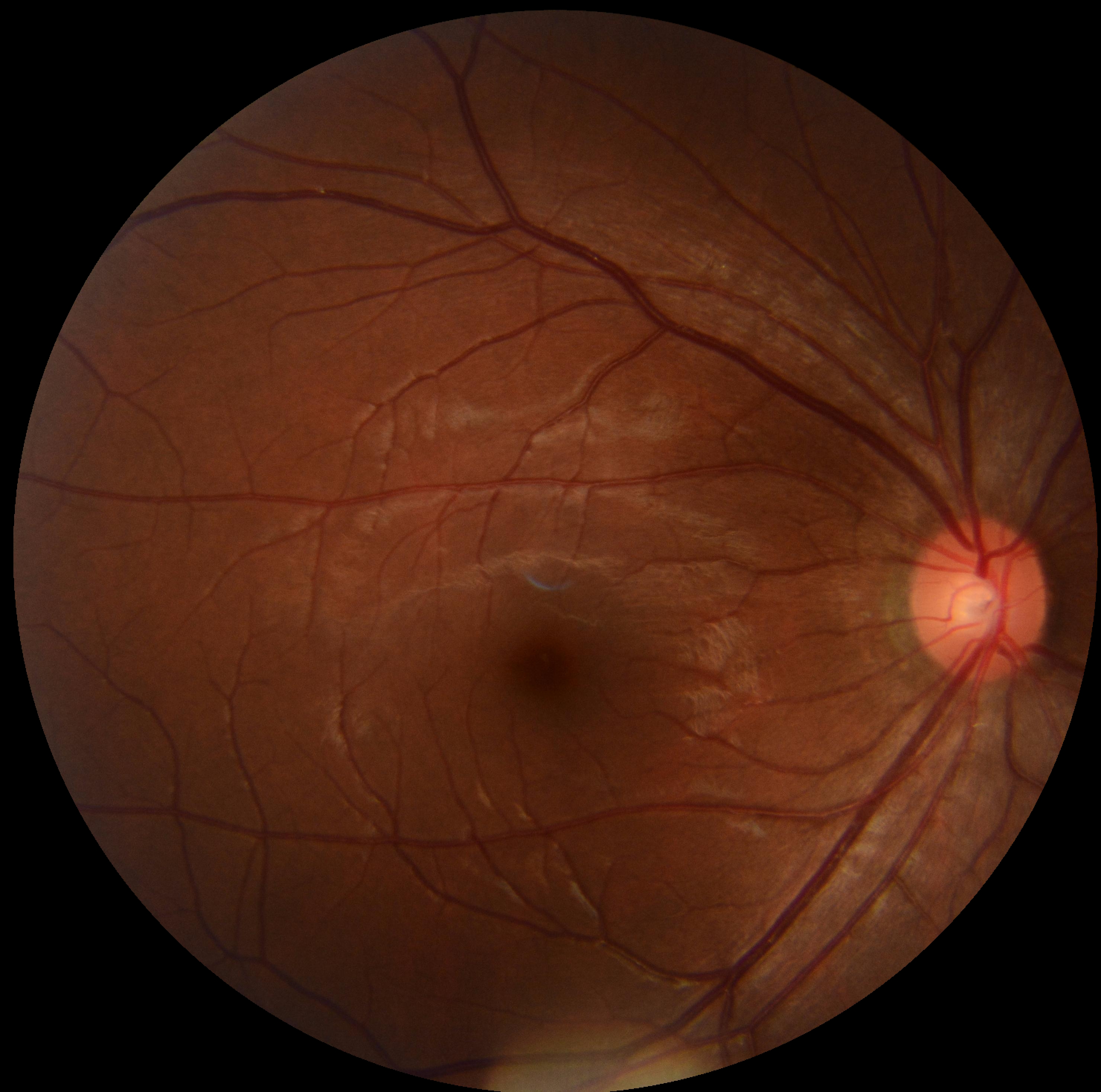 Ddr Detection Dataset Object Detection Dataset And Pre Trained Model By Research