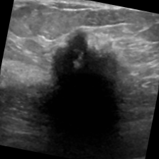 Ultrasound Images Obj Detection Object Detection Dataset by DL Assignment2