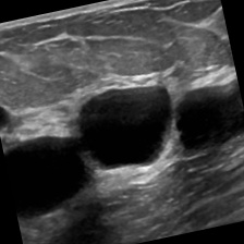 Ultrasound Images Dataset Classification Dataset by DL Assignment2