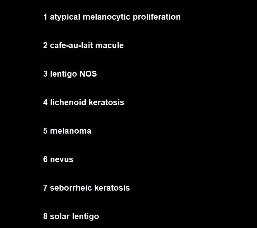 nevus Object Detection Dataset by Melanoma Original