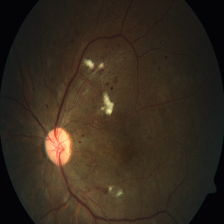 DR-Classification Classification Model by Macromrit