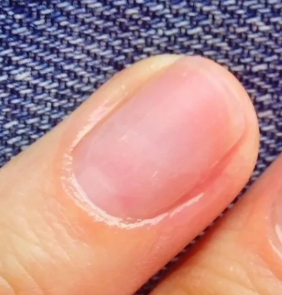 nail Instance Segmentation Dataset by pnslavergne@gmail.com