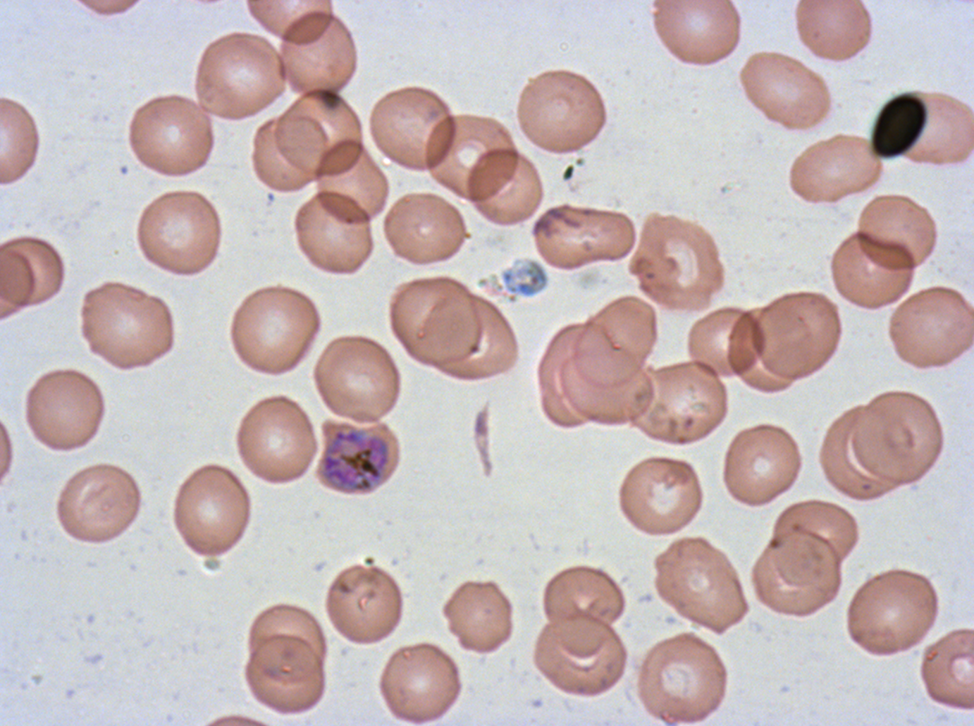 Malaria(Falciparum) Object Detection Dataset by Robo dataset