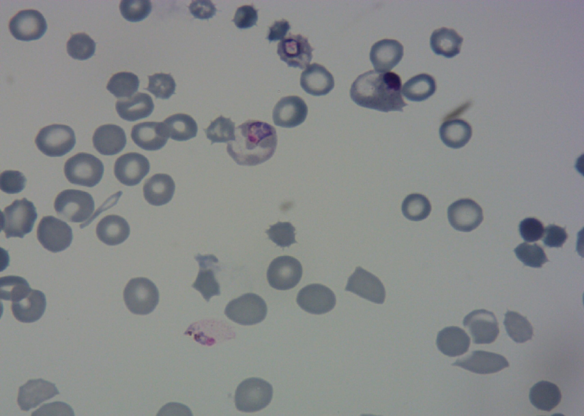 Malaria - Final Yata Object Detection Model by Robo dataset