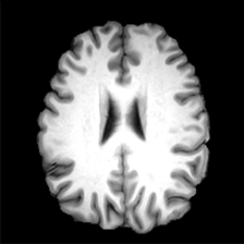 MRI Depression Classification Model by school