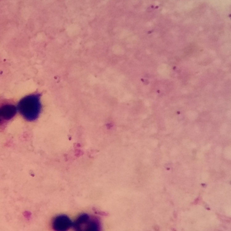 Malaria Detection 1182 Imagenes Object Detection Dataset By Malaria