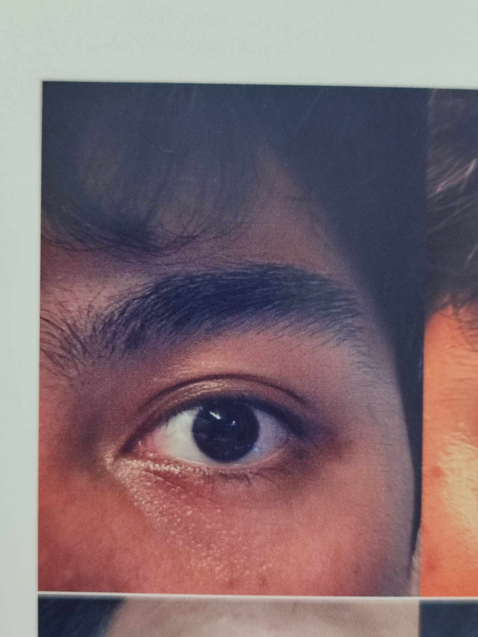 Iris fake detecotr Object Detection Dataset and Pre-Trained Model by Thesis