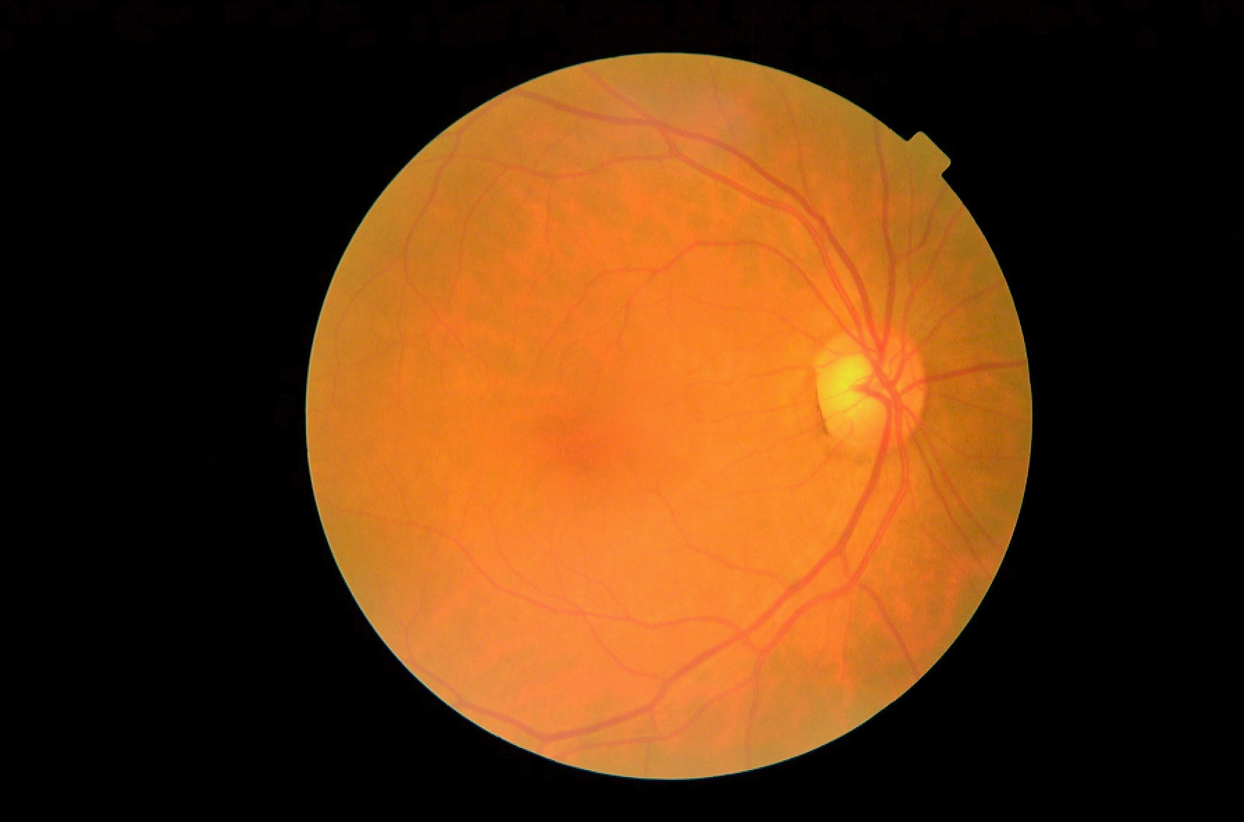 Eyes 2 Object Detection Dataset by Bitter Gourd Augemented Dataset