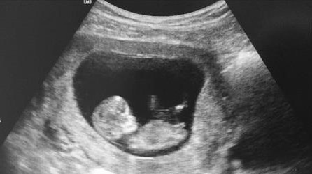 loask Object Detection Dataset by new-workspace-bkwah