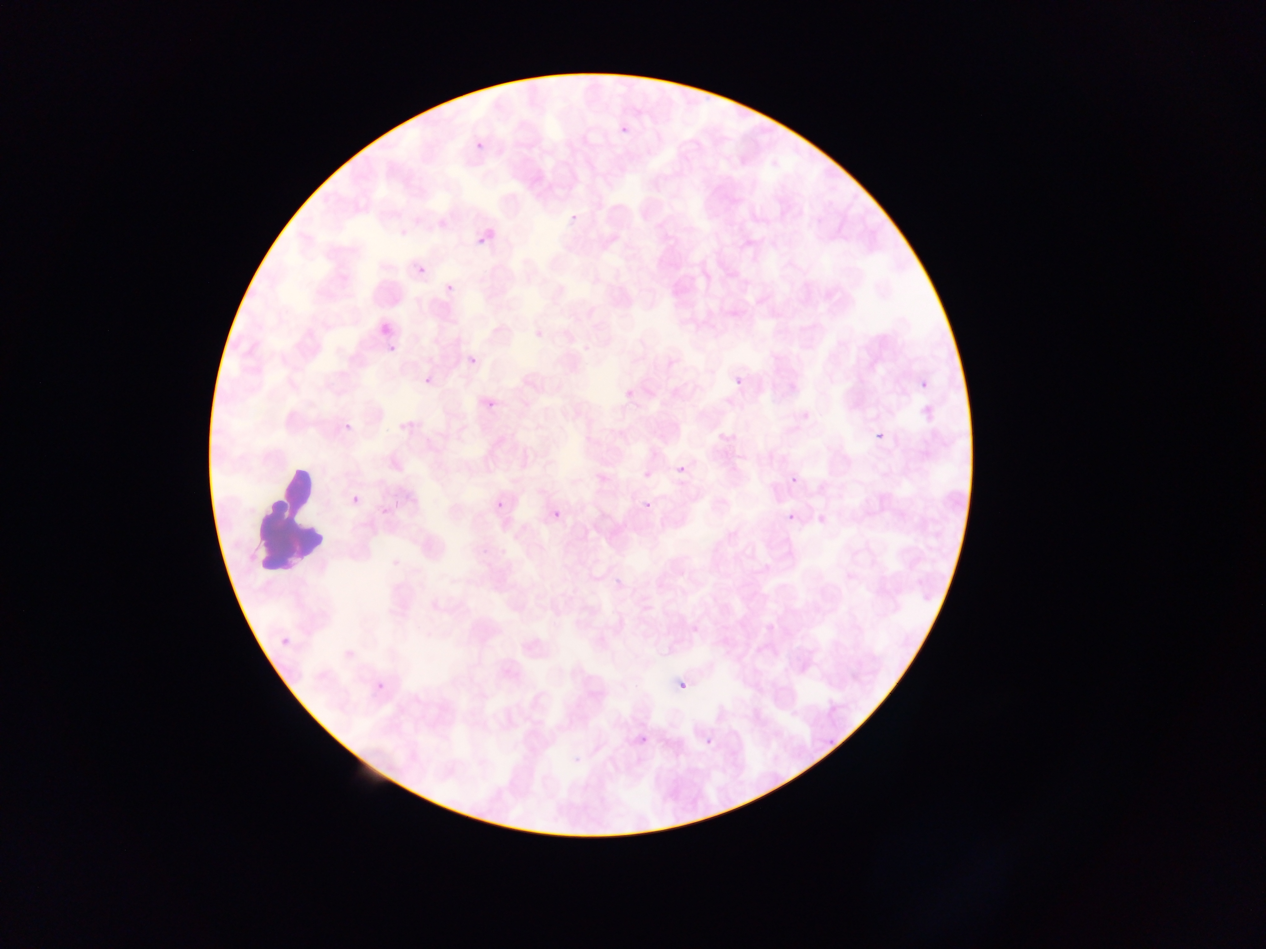 Malaria Data Object Detection Model By Malaria Data