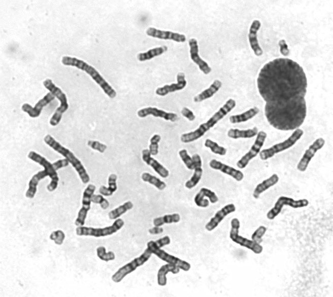 Chromosome Classification Classification Dataset by NghienCuuKhoaHoc Chromosome Classification Classification Dataset by NghienCuuKhoaHoc